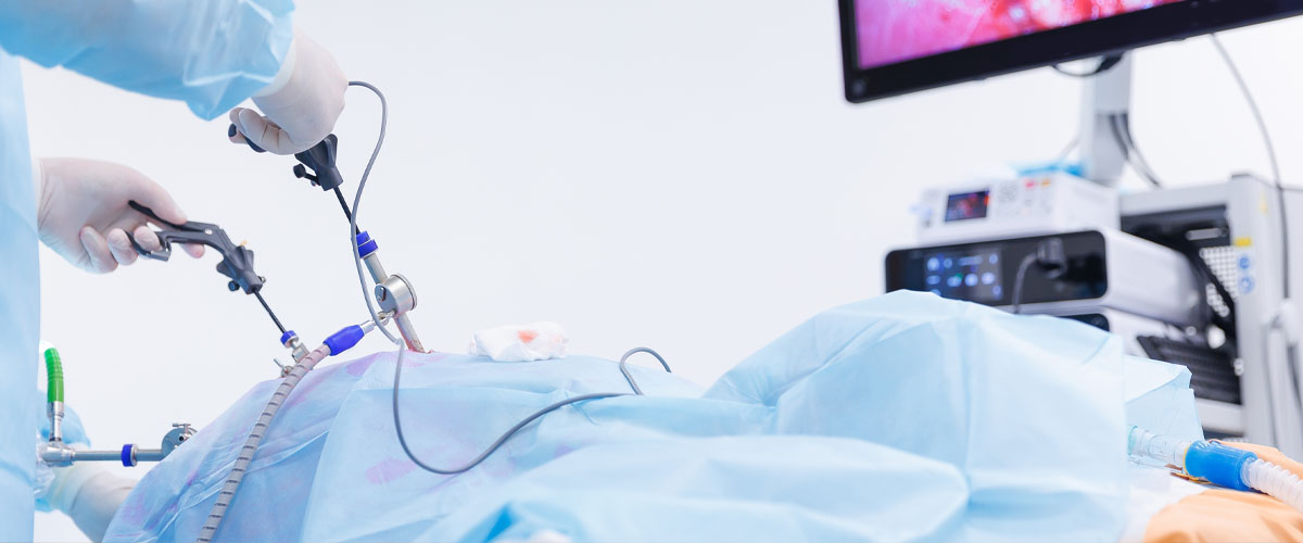 Laparoscopic Cholecystectomy - Dr Maahir Kariem